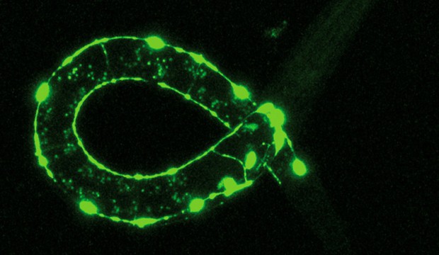Mechanisms of forgetting discovered in C.elegans
