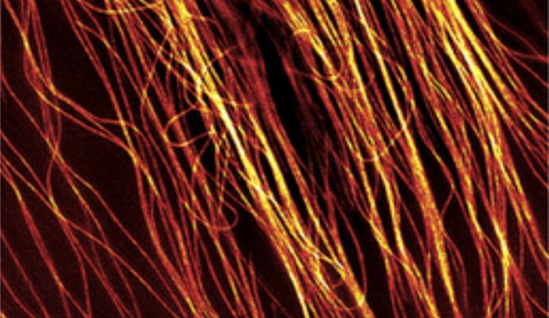 A new molecule for high-resolution cell imaging